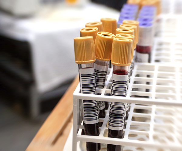 Liquid Biopsies in Transforming Cancer Patient Care: AACR Partners with ...
