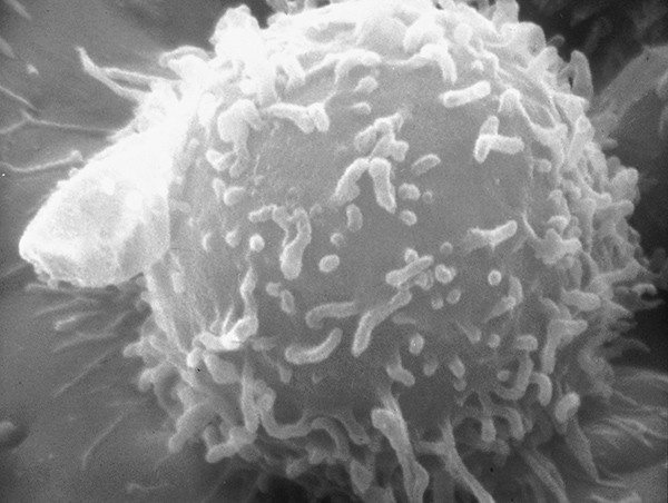 What's New in Immue Cell Therapy Research? | AACR Blog