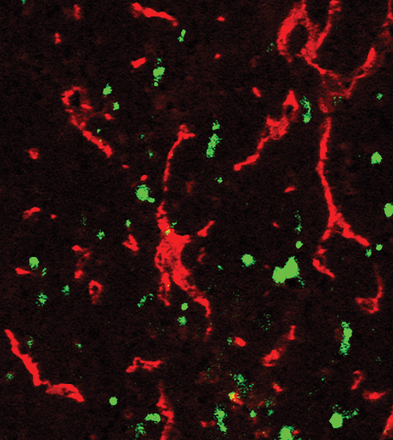 AACR Journals Editors’ Picks for July - American Association for Cancer Research (AACR)