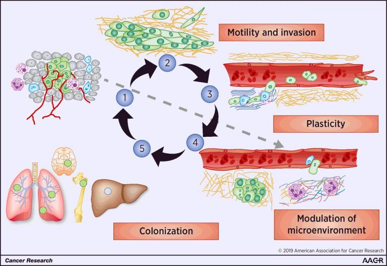 AACR Virtual Annual Meeting II: Insights into Cancer Metastasis Reveal ...
