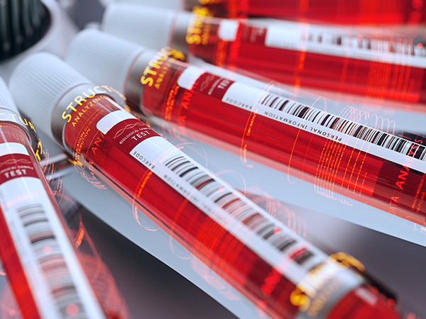 Researching Liquid Biopsy in Cancer Care | AACR Stories