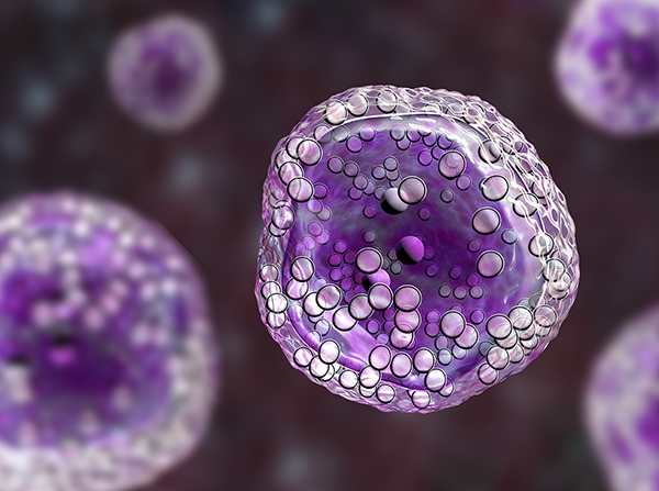 Artificial Intelligence for the Diagnosis and Treatment of Lymphoma ...