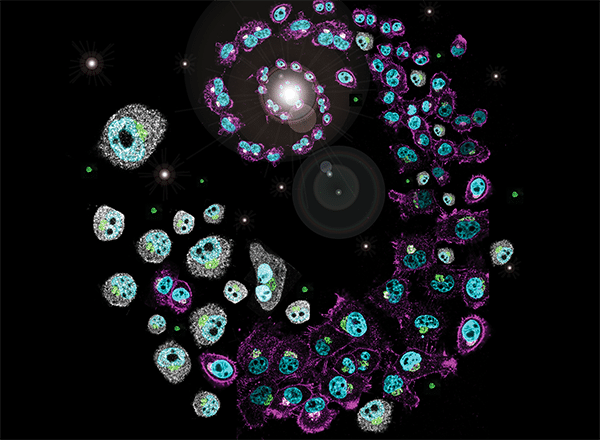 Editors’ Picks: May Highlights from the AACR Journals - American Association for Cancer Research ...