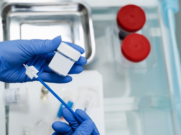 Self-collection Broadens Access to HPV Screening - American Association ...