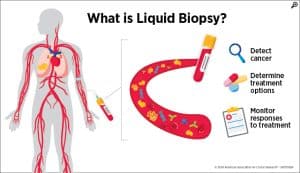 What Is Liquid Biopsy? | Blog | AACR