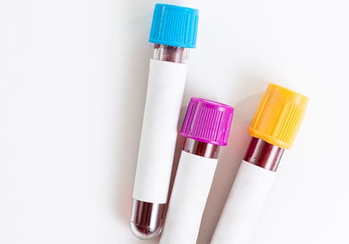 What Is Liquid Biopsy? | Blog | AACR